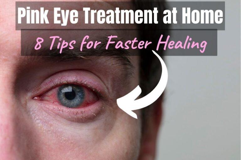 Pink Eye Treatment at Home - 8 Tips for Faster Healing